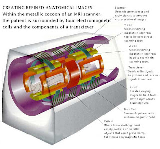 How Magnetic Resonance Imaging (MRI) Works - Electrical and Electronics ...