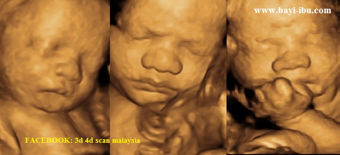 3D 4D Scan Malaysia : PACKAGE 3D 4D SCAN MALAYSIA