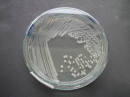 Perbedaan Isolasi Bakteri Secara Pour Plate, Streak Plate, Spread Plate ...