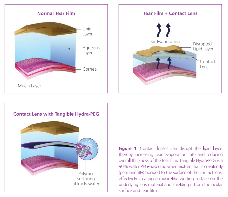 Cloudy with a Chance of Fog: Today's Best Options for Fighting Contact ...