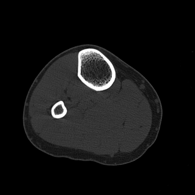 CT Knee - Radiology Imaging