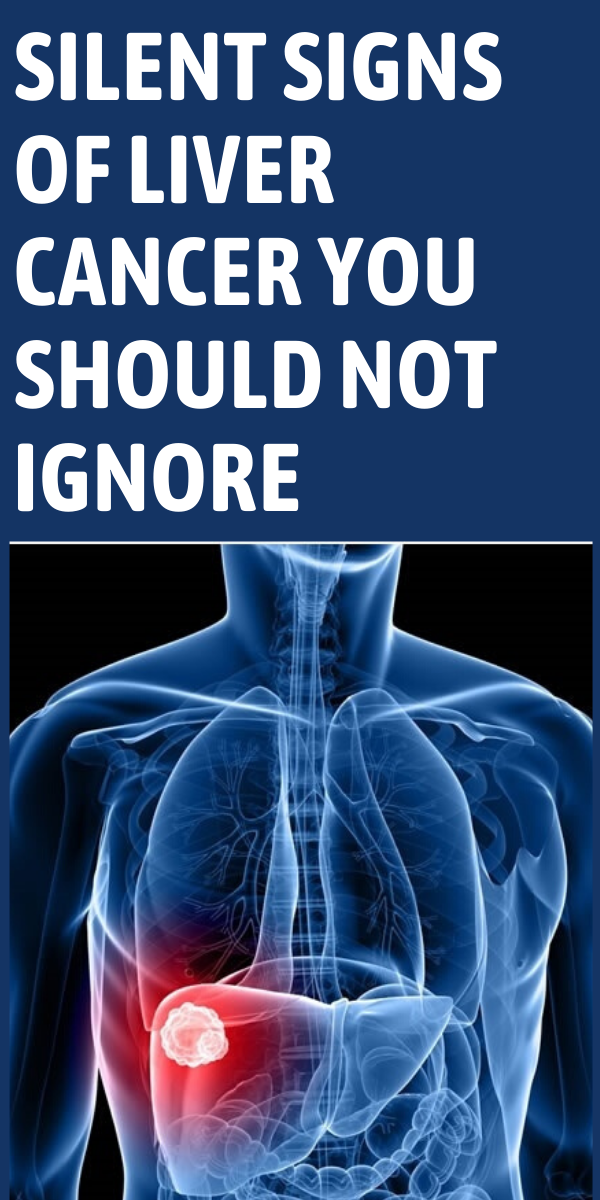 Silent Signs Of Liver Cancer You Should Not Ignore - Liver Cancer Early ...