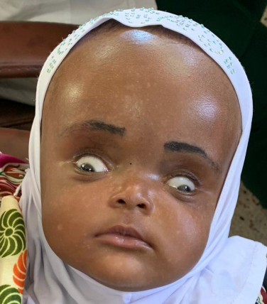 Ophthalmology Notes: ASTRONOMICAL NOMENCLATURE IN OPHTHALMOLOGY