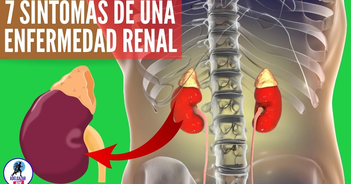 7 Síntomas que te ALERTAN de una Posible Enfermedad en los Riñones