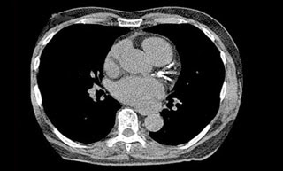 Computed Tomography: May 2015