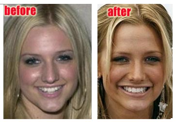 Did They Ashlee Simpson a Nose Job?