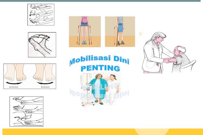 SAP MOBILISASI PASIEN POST OPERASI SC
