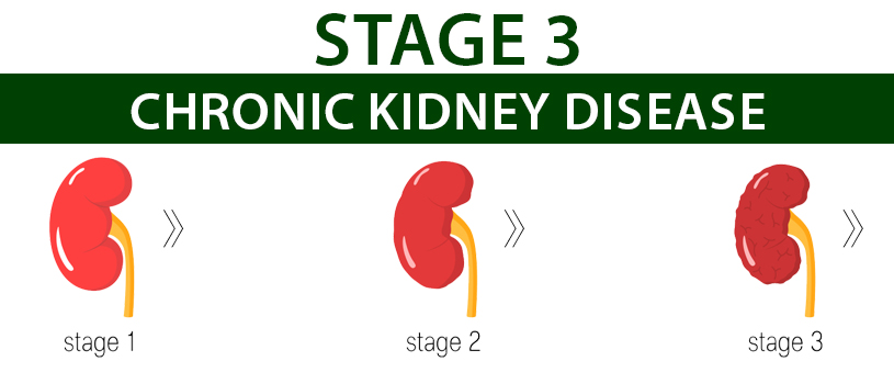 Is Stage 3 Chronic Kidney Disease Fatal is-stage-3-chronic-kidney-disease-fatal