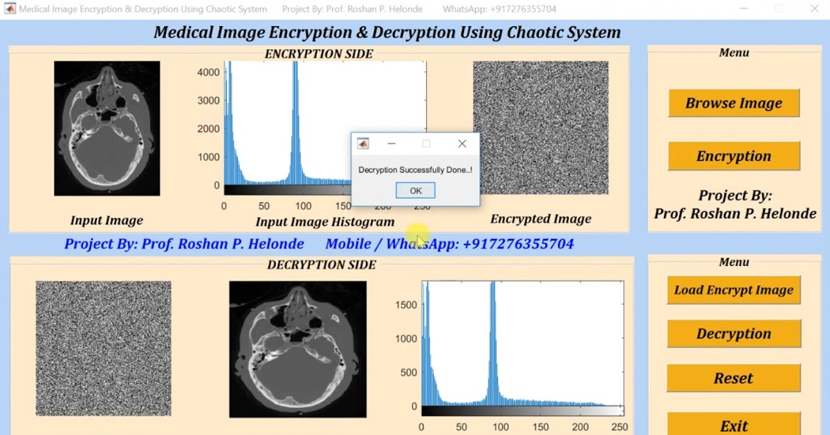 Medical Image Encryption Decryption Using Chaotic System Matlab Project ...