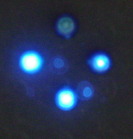 Eye 2 Eye Optometrists: Flashes of Light, Colored Haloes, Floating ...