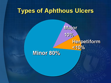 Discovering Aphthous Stomatitis: The 3 Clinical Forms of Aphthous ...