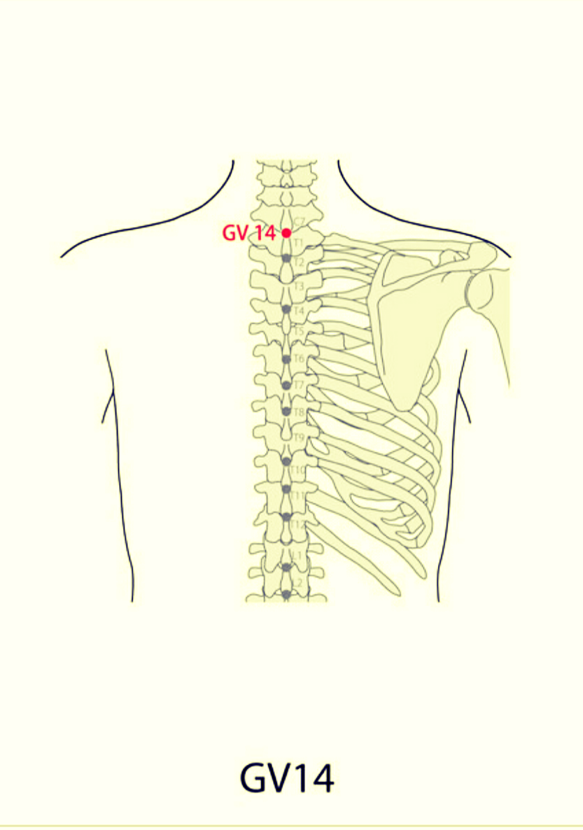 SaroEpic Acupuncture : Acupuncture points for dry cough