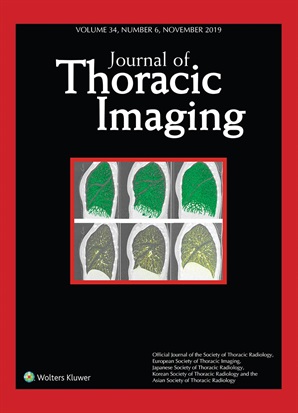 Los más populares en el Journal of Thoracic Imaging