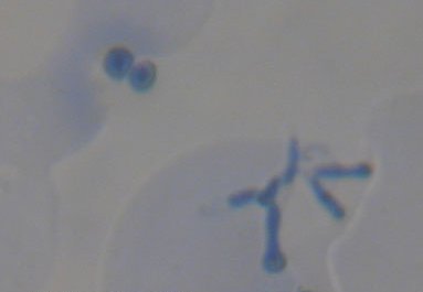 Microbiología y Epidemiología: Trichophyton rubrum. Trichophyton ...