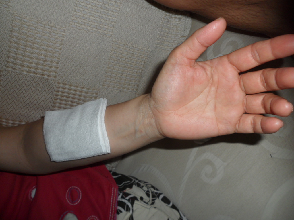 First-Aid Kid: Wound Management Part 2