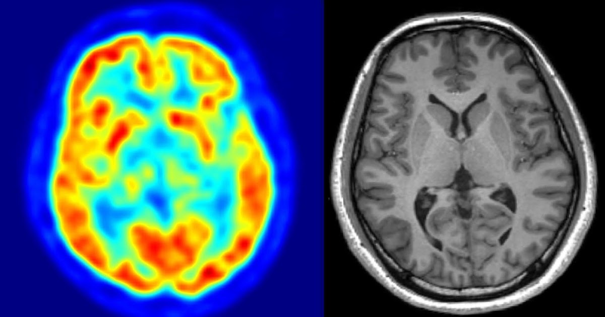 Central Clinical School News Blog: Healthy participants sought for ...