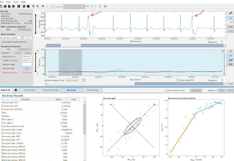 Muscle Oxygen Training: Movesense HR+ and Medical ECG review