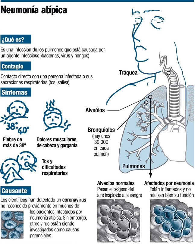 Futura médica... y algo más: NEUMONÍA