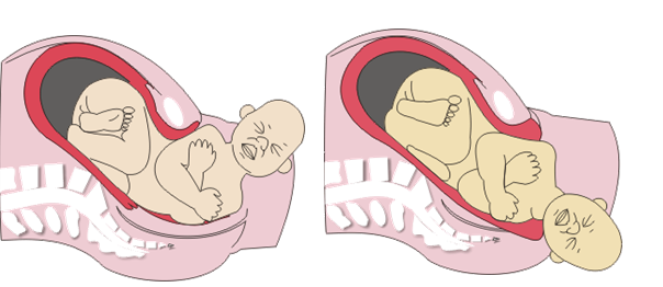 PARTOS TECNOLÓGICOS Y NATURALES: PARTOS TECNOLÓGICOS Y NATURALES