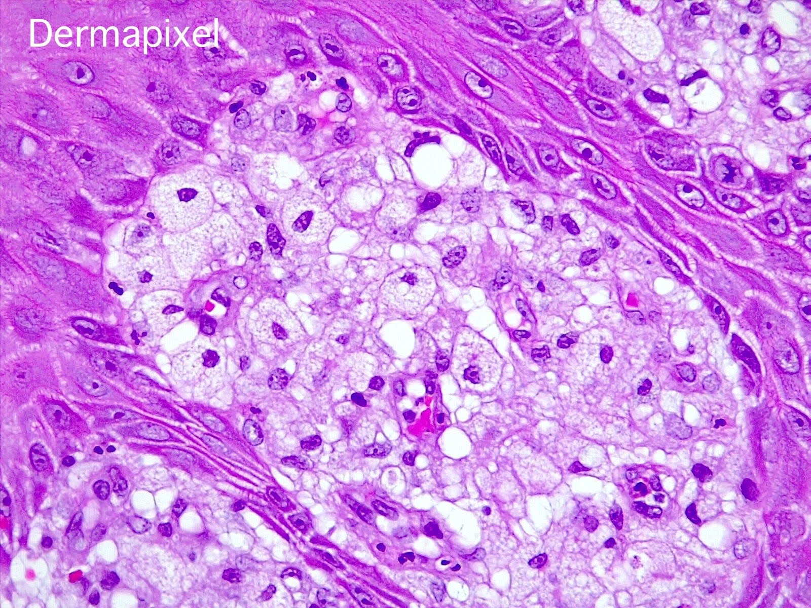 Dermapixel: marzo 2021