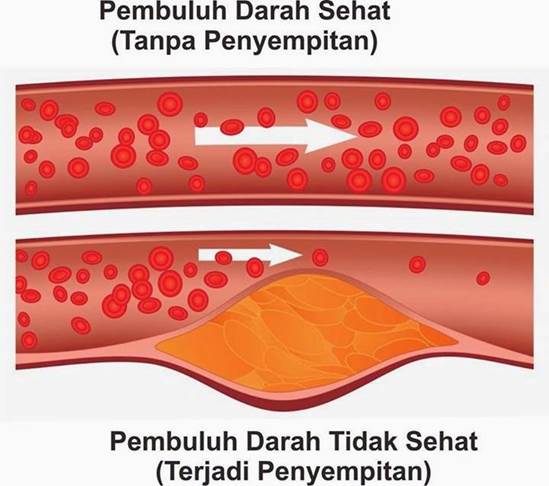 Cara Mengukur Kadar Kolesterol yang Normal dalam Tubuh - ALAMI TRADISIONAL