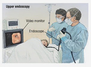 ENDOSCOPY Saluran Cerna | Info Kesehatan