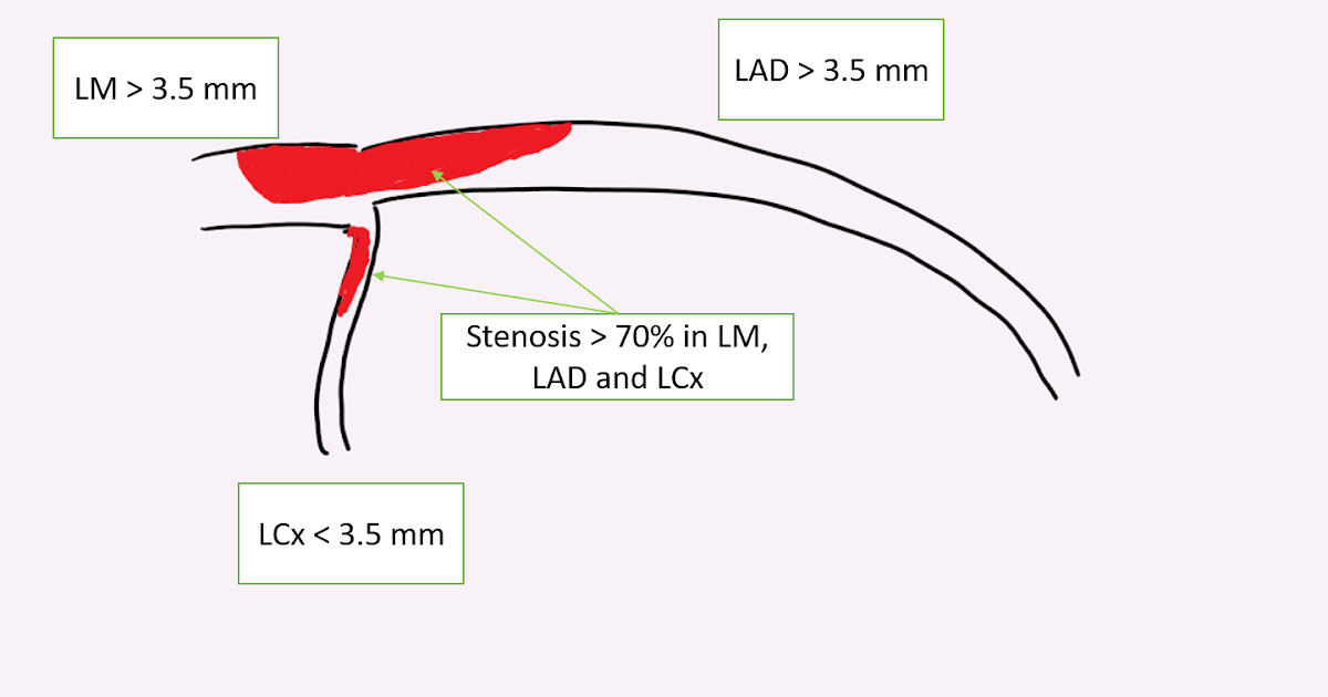 MCQ. ABCD classification for LM disease