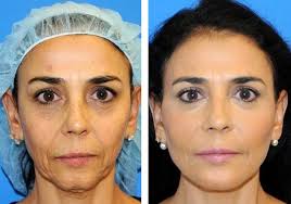 Plastic Surgeon In Lahore | Plastic Surgery Clinic Pakistan ...