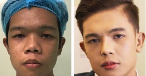 Marlou Arizala to Xander Ford ~ Philippines Daily Headlines