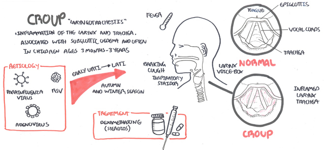 CLINICAL CASE PRESENTATION -CROUP
