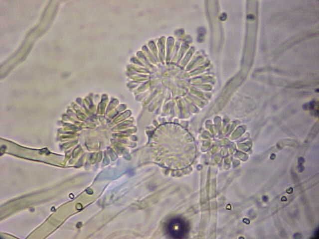 Sustainable Mycology: Syncephalastrum spp.