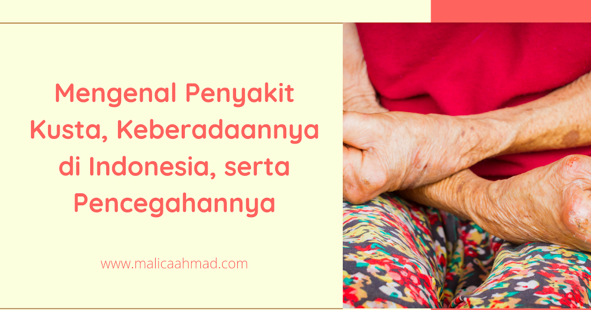 Mengenal Penyakit Kusta, Keberadaannya di Indonesia, serta ...