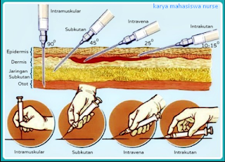 SOP INJECTION IM,IV,SC,IC - explore