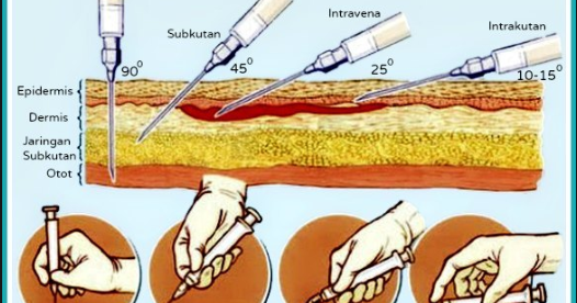 SOP INJECTION IM,IV,SC,IC - explore