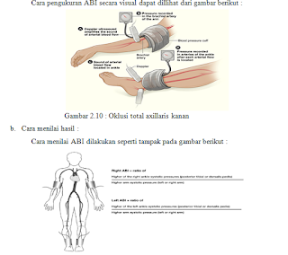 Pelangi Kehidupan: Asuhan Keperawatan Pada Pasien Dengan Acute Limb ...