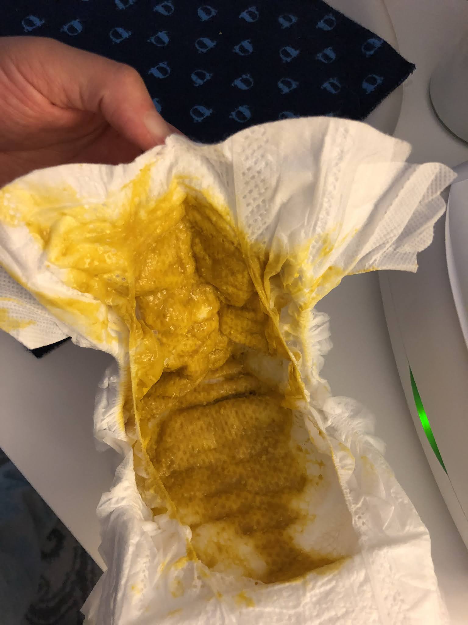 Diareea la bebelusi - de la cauze la tratament | Dr. Francu Nicoleta