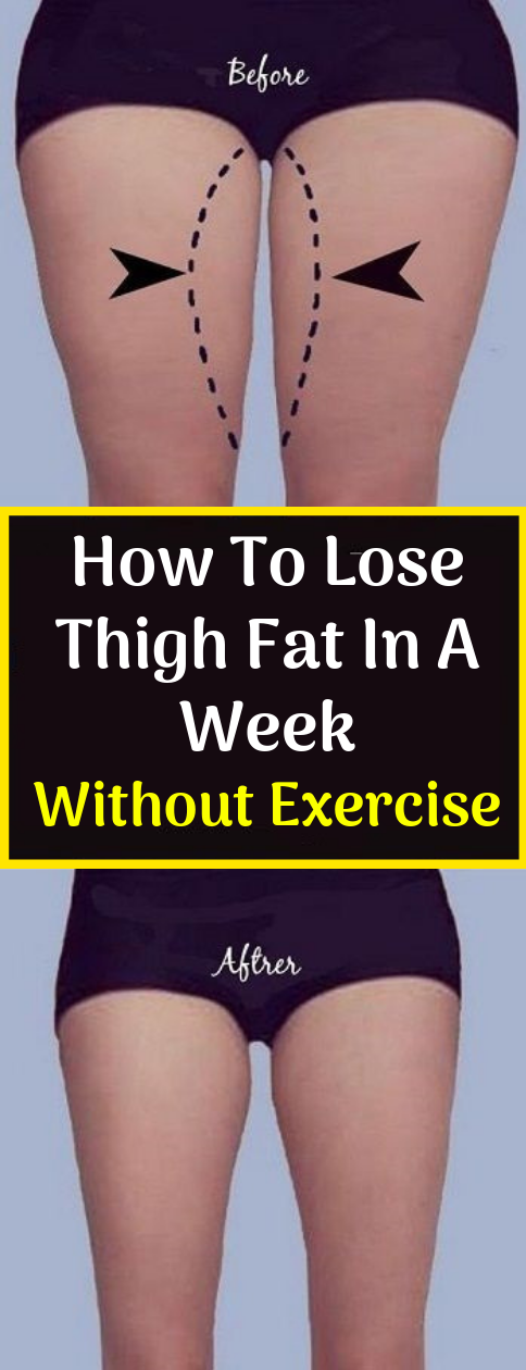Herbal Medicine How To Lose Thigh Fat In A Week Without Exercise Herbal Medicine How To Lose Thigh Fat In A Week Without Exercise