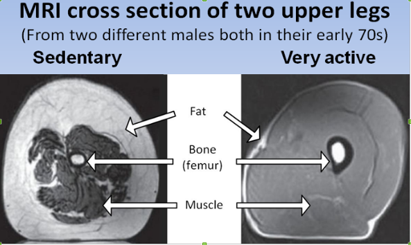 Why you should be resistance training like your life depends on it ...