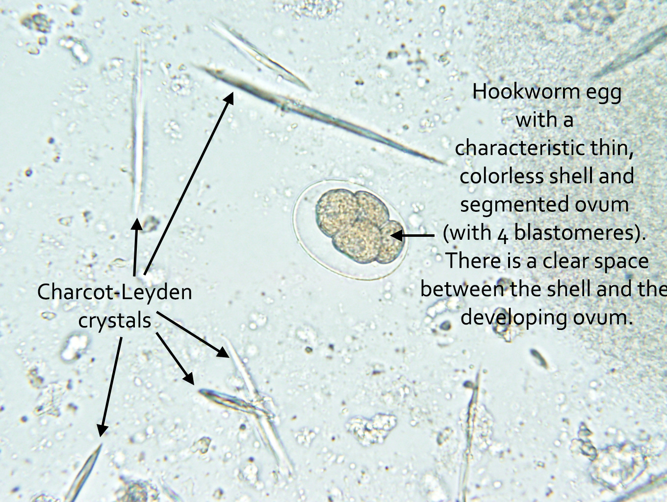 Hook Worm Eggs