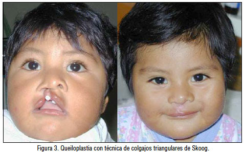 Futuras Fonoaudiólogas Utal: 2021