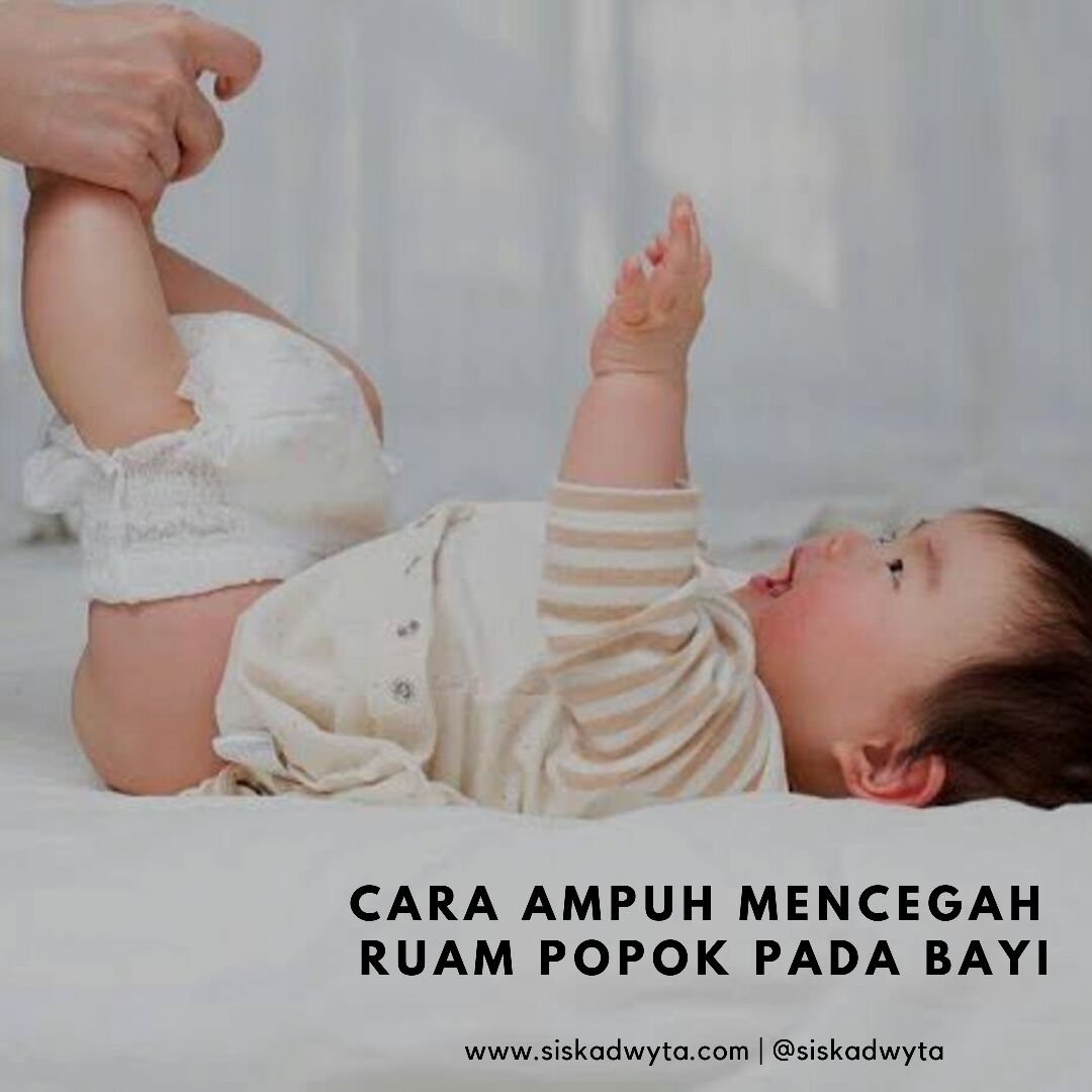 Cara Ampuh Mencegah Ruam Popok pada Bayi