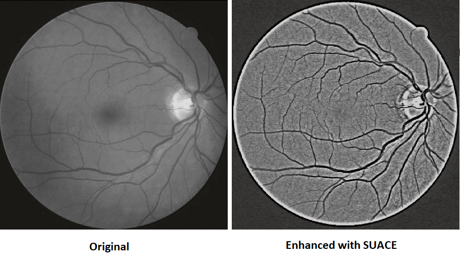 GitHub - ravimalb/suace: Speeded Up Adaptive Contrast Enhancement (SUACE); an OpenCV based ...