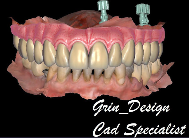 Arquivos EXOCAD para Download