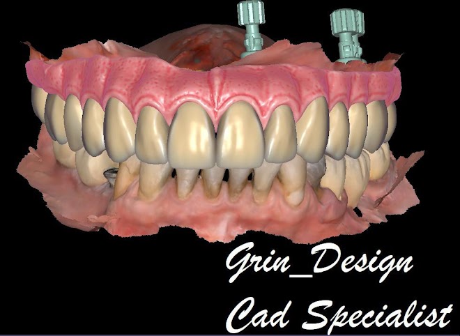 Arquivos EXOCAD para Download