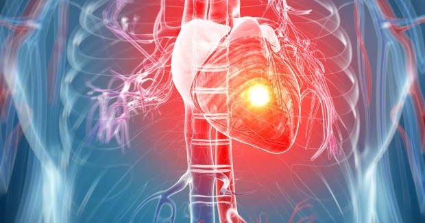 4 Major Heart Attack Red Flags You Need To Know