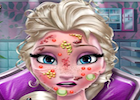 Elsa Skin Doctor |juegos de elsa de frozen