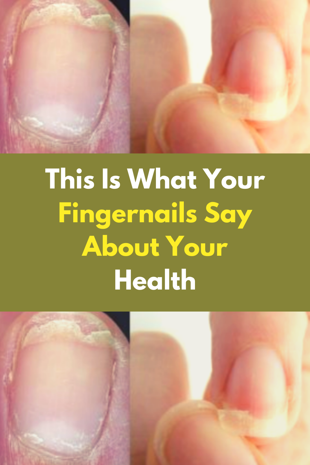 This Is What Your Fingernails Say About Your Health