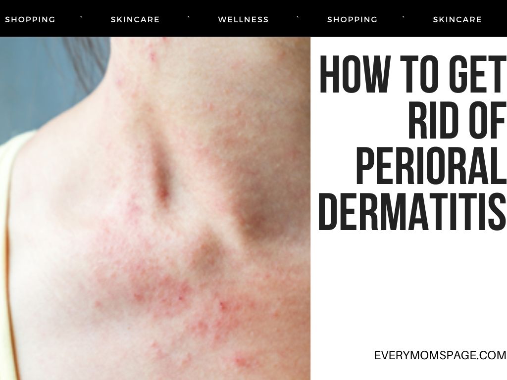 How To Get Rid Of Perioral Dermatitis how-to-get-rid-of-perioral-dermatitis