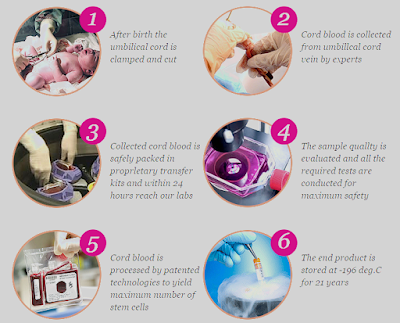 Stem Cells And It's Banking: Procedure of umbilical cord blood banking