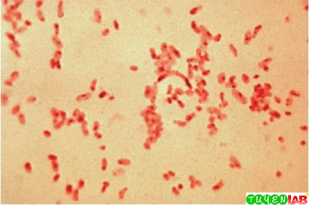 [Microbiology] Atlas of Anaerobes of Clinical Importance | Free Medical ...